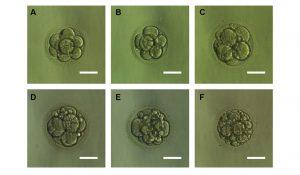 Embryo Grading - Quality Chart and IVF Success Rates
