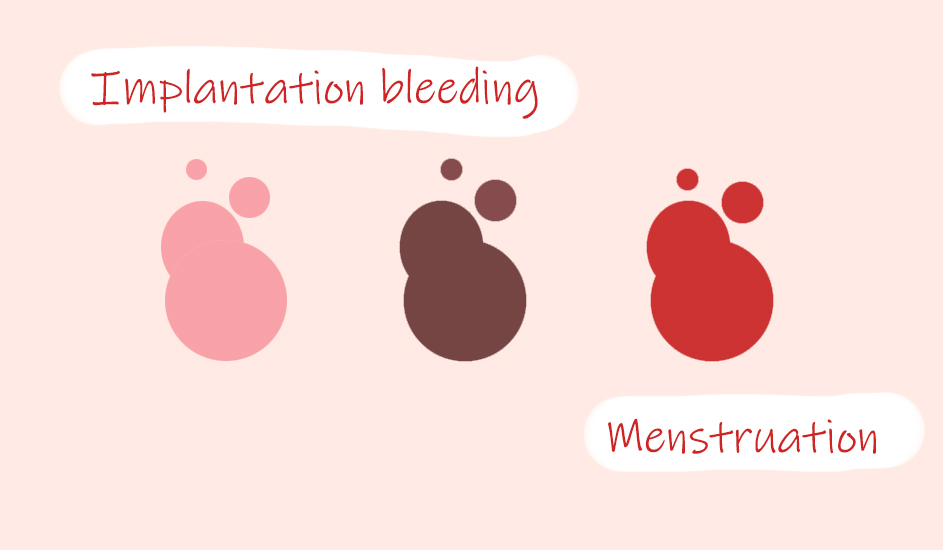 When Should I Expect Implantation Bleeding After Embryo Transfer When Should I Expect Implantation Bleeding After Embryo Transfer